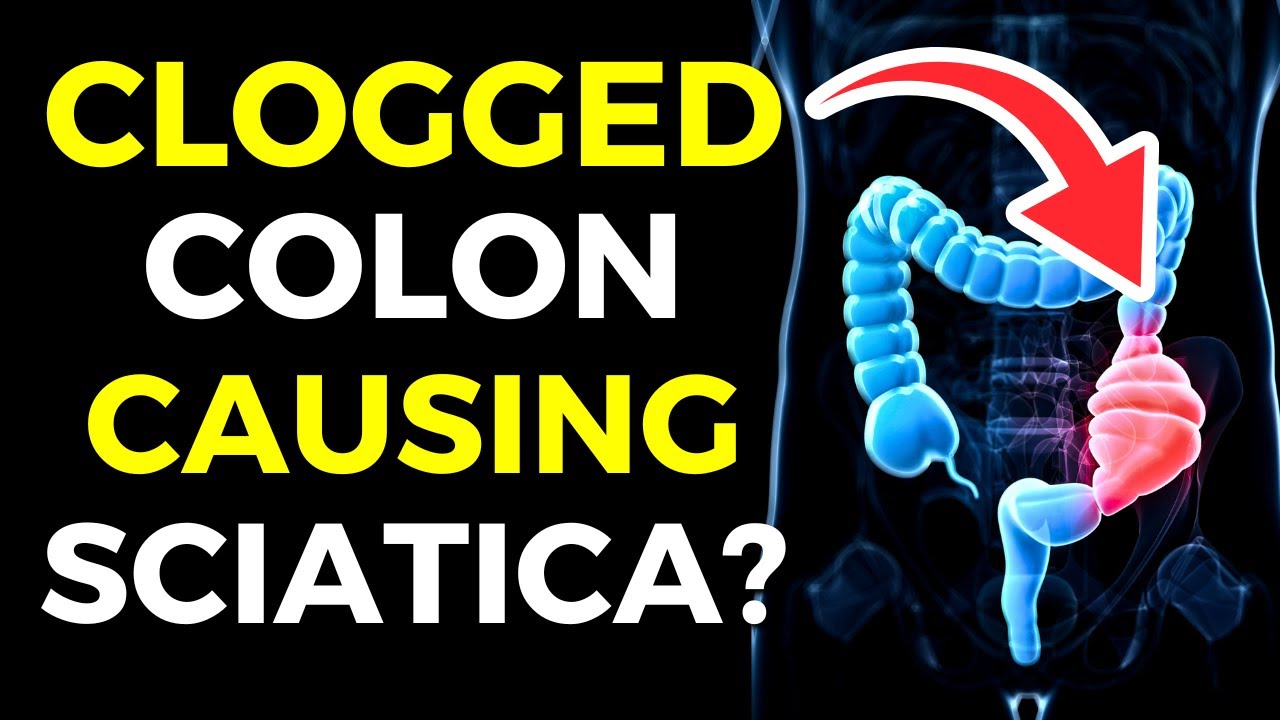 Is Constipation Causing Your Sciatica?! Causes & Solutions REVEALED