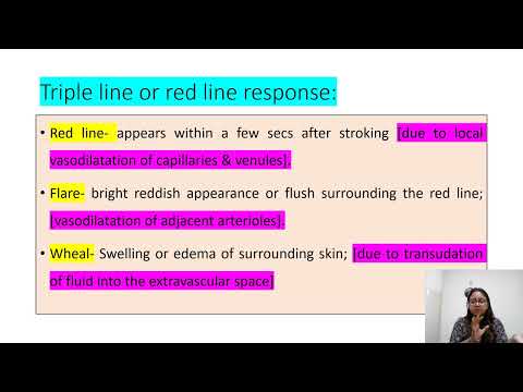Inflammation [Vascular events]