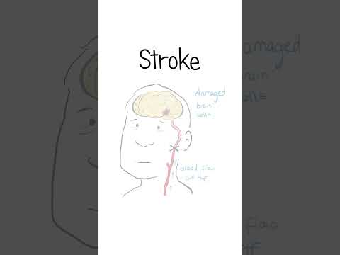Strokes Explained #healthsketch #shorts