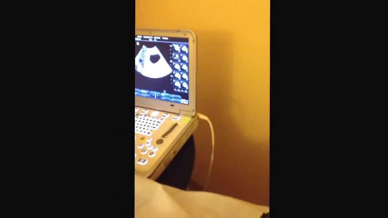 It's a baby!!
