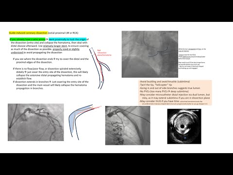 Guide dissection: cases and management
