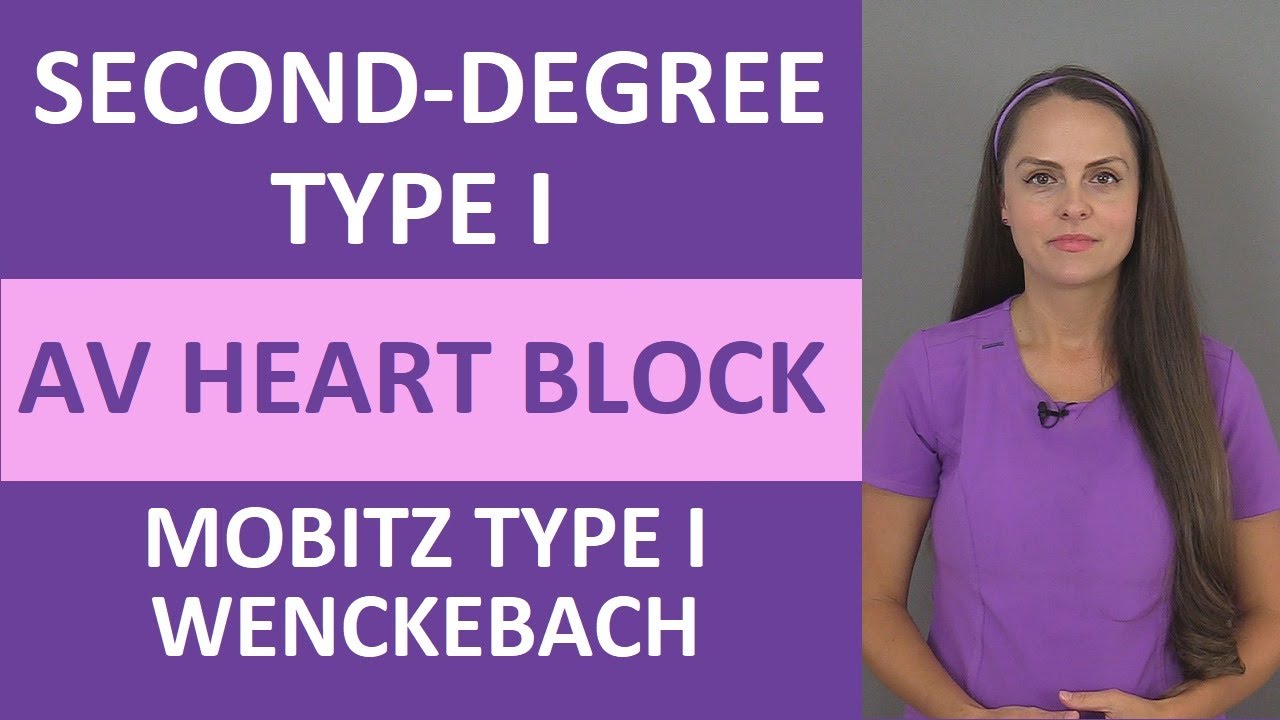 Second-Degree Type I AV Heart Block Nursing NCLEX ECG | Mobitz Type 1 | Wenckebach