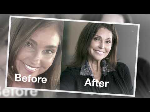Sabrina Falcon's story: A regenerative approach to facial reconstruction after cancer