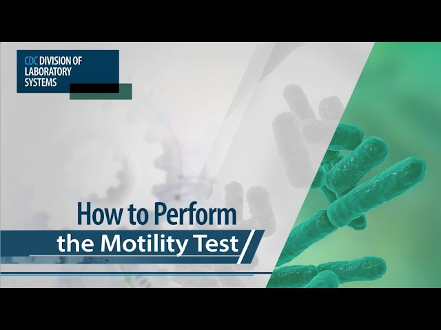 A Comprehensive Guide to Performing the Motility Test for Bacteria ...