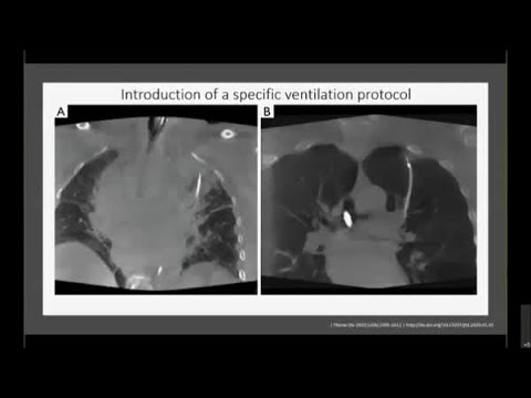 Accuracy Is Everything: Recent Clinical Evidence in Navigation