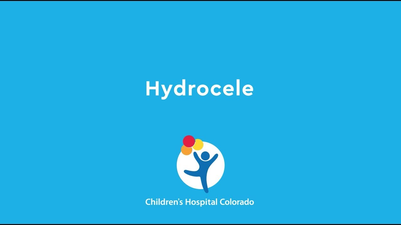 What is Hydrocele Surgery?