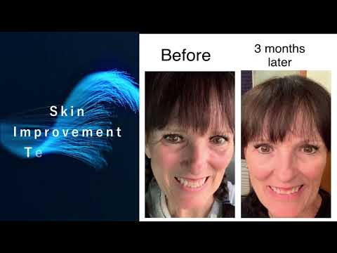 Prife iTeraCare THz Health Blower testimonies on Animals…Before….After ...