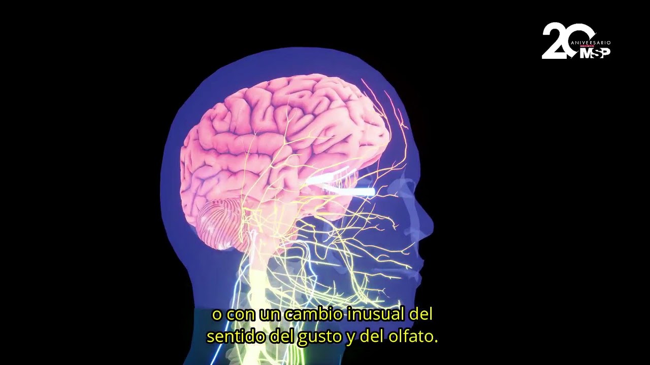 Conoce los 5 tipos de epilepsia que existen en el Día Internacional de la Epilepsia - #EspecialMSP