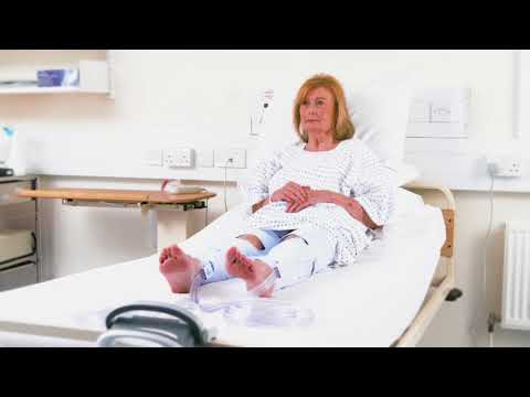 Kendall SCD™ Sequential Compression Review