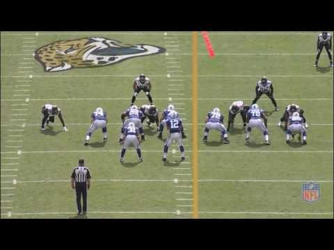 Kick Out Pulls on Trap and Counter- LINEPROTIPS 006