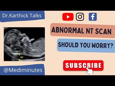 Abnormal NT Scan What To Do Next | Nt Scan In Tamil