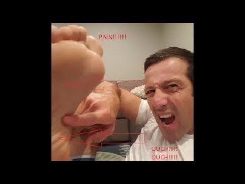 Foot Pain, Top of Foot Pain, Self Diagnose Foot Pain, Ball of Foot Pain, Metatarsal Pain