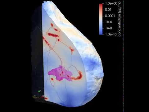 Drug Delivery to Breast Cancer Cells through Tissue