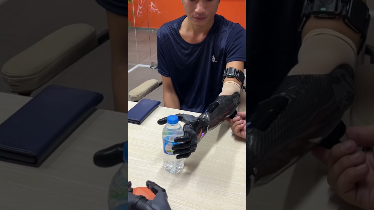 Vulcan Upper Limb Prosthetic Arm Fitting Day #shorts