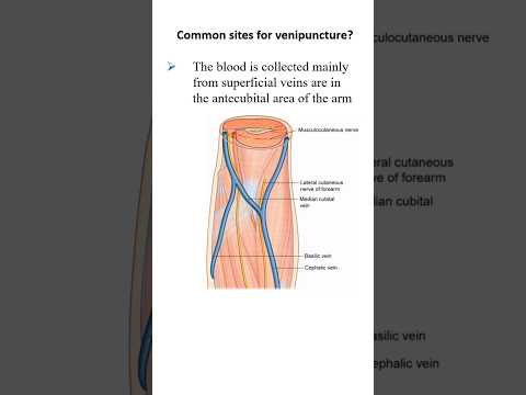 Blood collection vein in antecubital area