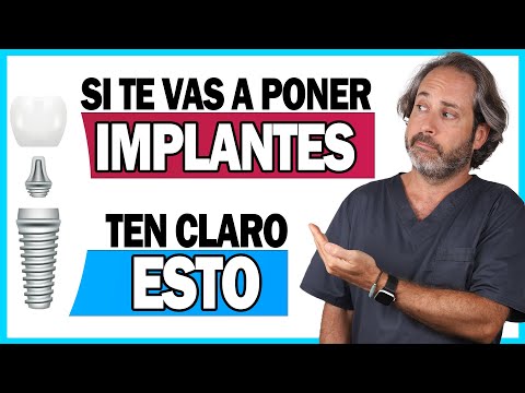 📌𝗜𝗡𝗙𝗢𝗥𝗠𝗔𝗖𝗜𝗢𝗡 𝗖𝗟𝗔𝗩𝗘 sobre la 𝗖𝗢𝗟𝗢𝗖𝗔𝗖𝗜𝗢𝗡 𝗜𝗠𝗣𝗟𝗔𝗡𝗧𝗘𝗦 dentales paso a paso explicada (TE INTERESA 👌)
