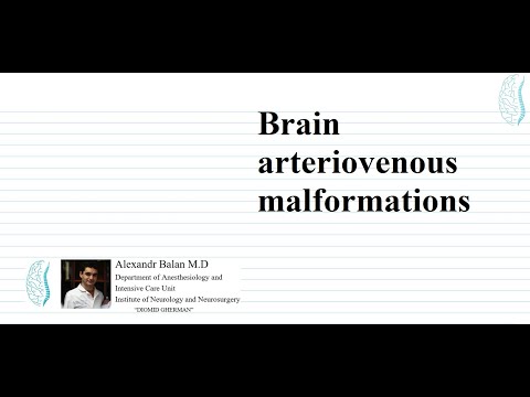 Brain Arteriovenous Malformations