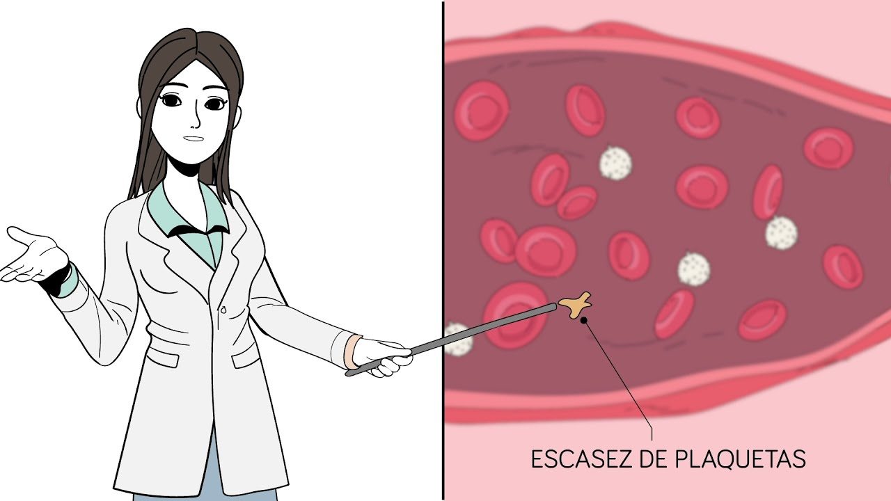 Síndrome antifosfolípido: qué es, síntomas y tratamiento
