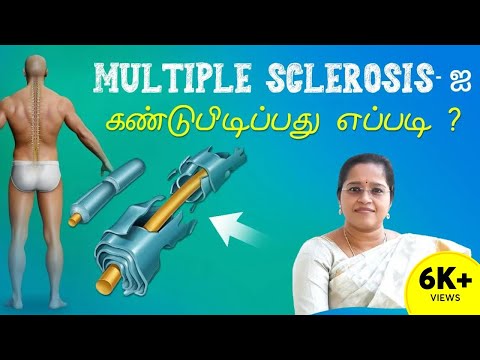 Multiple sclerosis - ஐ கண்டு பிடிப்பது எப்புடி ? | Dr. A.VENI | RockFort Neuro Centre | Trichy