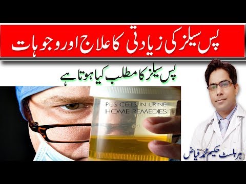 Pus cells Meaning | Pus cells ki zayadti ka ilaj In urdu | In Hindi