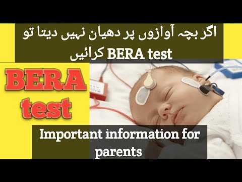 BERA test | ABR test | @selflessmedicose