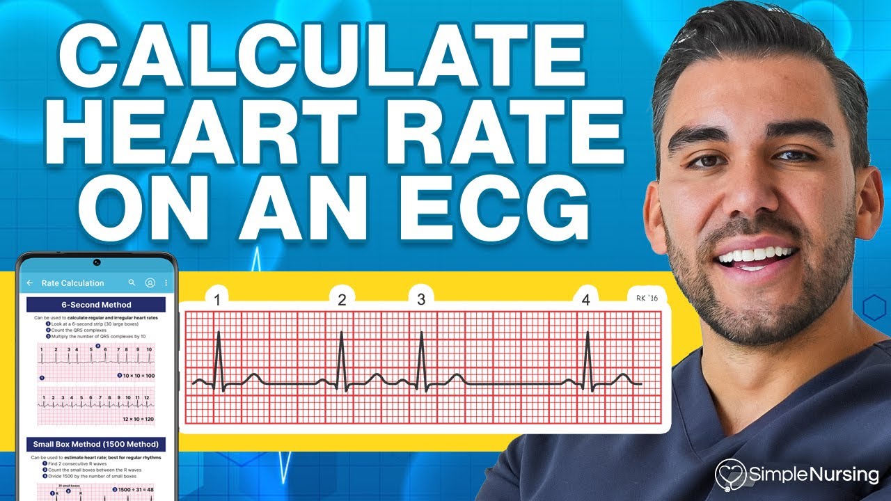 How to Calculate Heart Rate on ECG: Easy Steps to Master Pulse Counting