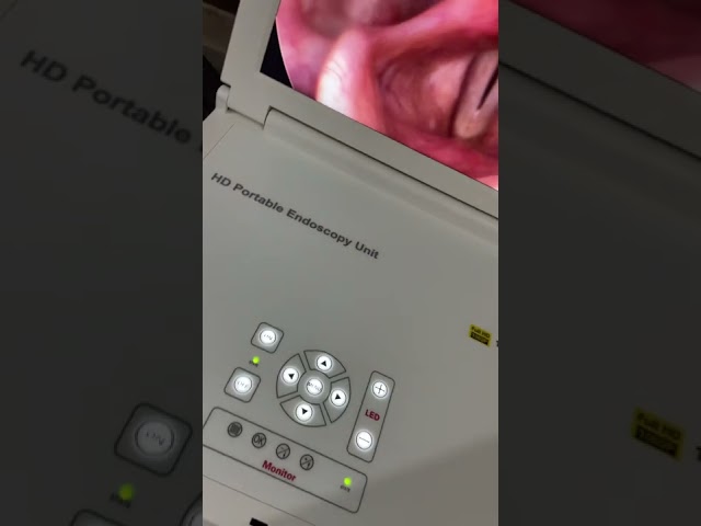 ENT Otolaryngology Equipments - ENT Opd Treatment Examination Unit ...