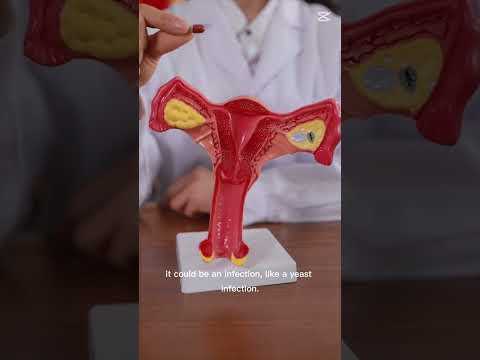 what does whit vaginal discharge mean? #vaginaldischarge