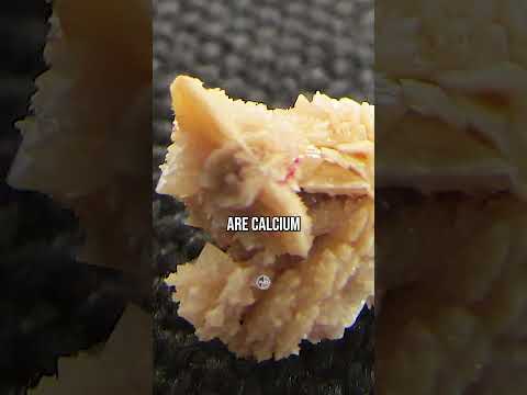 "Can I Do KETO Diet With KIDNEY STONES?" 👉