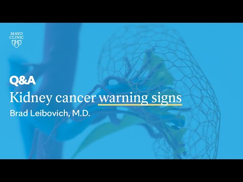 What are the warning signs of kidney cancer? Brad Leibovich, M.D., Mayo Clinic