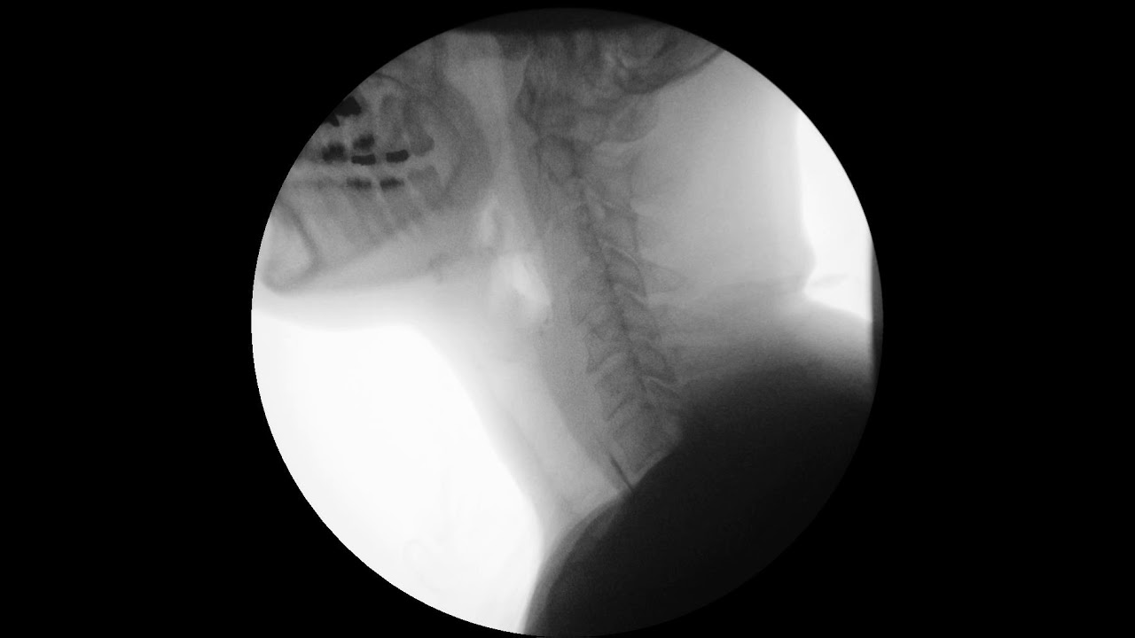 Insight Essentials MBS Example 1