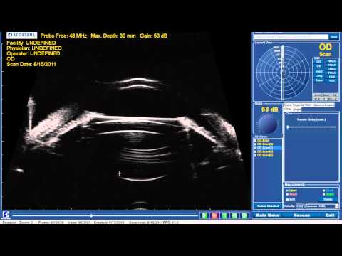 A scan Biometer - A Scan Machine Latest Price, Manufacturers & Suppliers