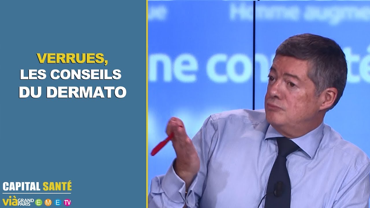 Verrues, les conseils du dermato