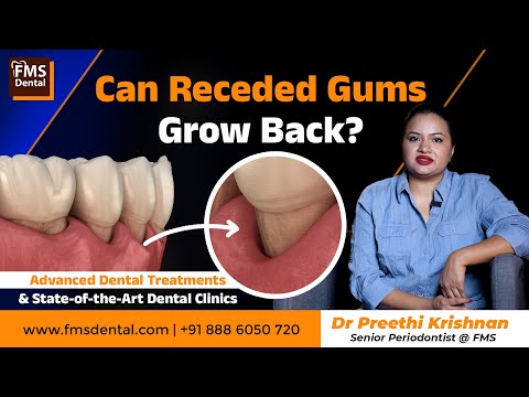 Can Receding Gums Grow Back? | Gum Recession Treatment Explained by Experts