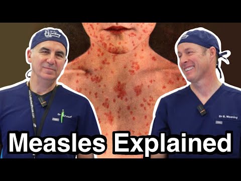 Measles. Does The Vaccine Work?