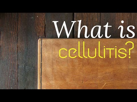 What is cellulitis?