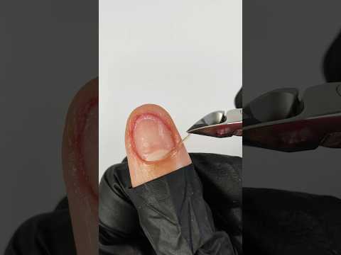 HOW TO EASILY FIX MY DAMAGED NAIL AT HOME!๐
๐ป