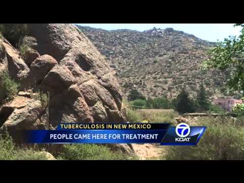 The History Of Tuberculosis In NM