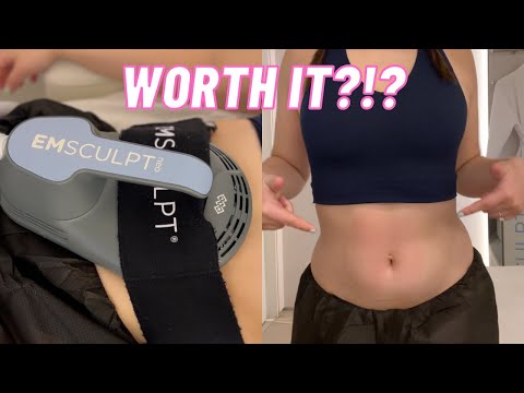 EmSculpt NEO Before and After Results + Honest Review