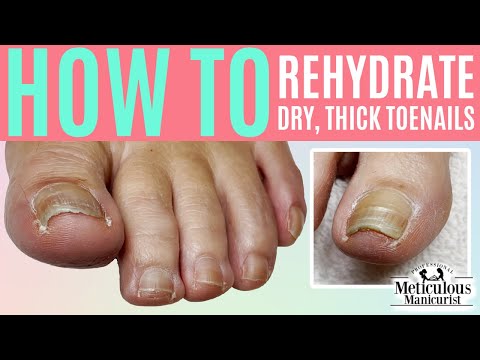 How to Rehydrate a Dry, Thick Toenail