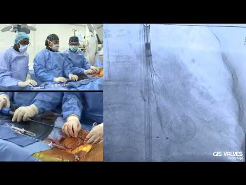 06 Dr Nabil Ismail King Faisal Center GIS Valves V4
