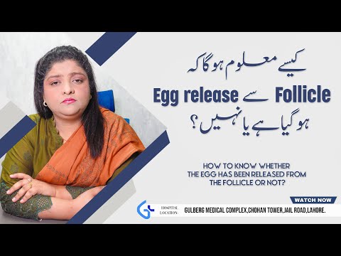 Understanding Ovulation to know when the Egg release from Folicle | Dr Naila Jabeen | Gynae Solution