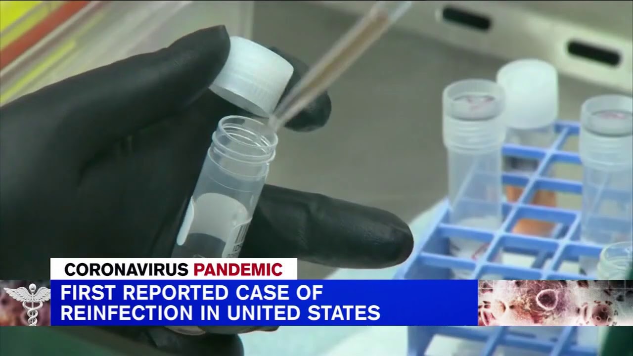 First reported case of COVID reinfection in U.S.