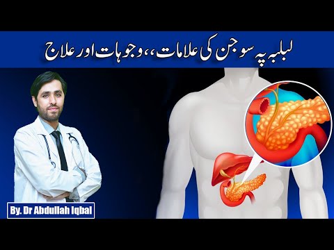 Pancreatitis | Acute Pancreatitis | Chronic Pancreatitis Causes, Symptoms & Treatment in Urdu
