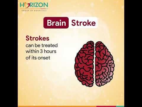 Brain stroke treatment | Patient review | Horizon Hospital