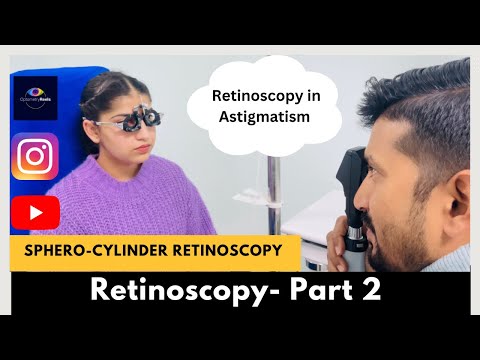 Retinoscopy Part 2 || Static Retinoscopy for astigmatism || Sphero-Cylinder method