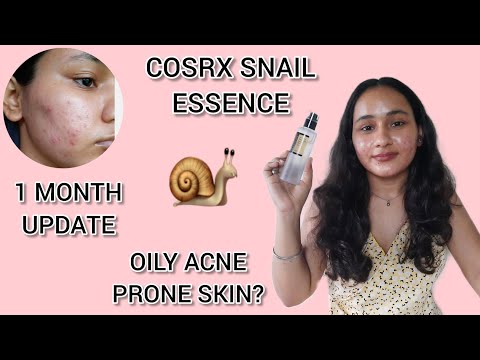 Cosrx Advanced Snail Essence| 1 Month Update| Works for Acne marks?| Khushi Mahla