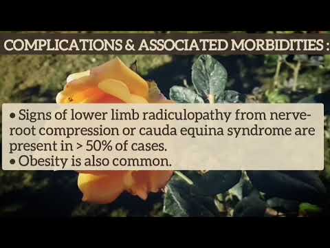 Achondroplasia Radiology Inheritance Symptoms Treatment