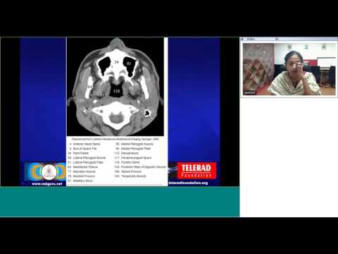 Maxillofacial CT anatomy by Dr Geetha Balasubramaniam