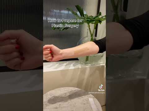 48 hrs Post Surgery